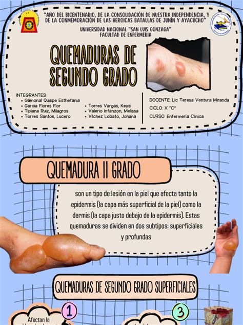 Guía Sobre Quemaduras De Segundo Grado Pdf Inflamación Quemar