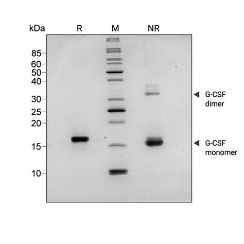 Recombinant Human G Csf Protein Animal Origin Free Qkine