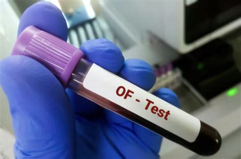 Osmotic Fragility Test Of Red Blood Cells Principle Procedure Precautions And Its Clinical
