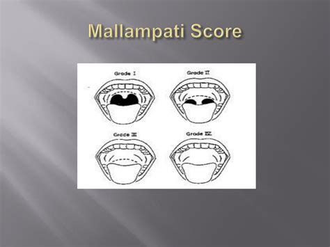 Ppt Airwaybasics Powerpoint Presentation Free Download Id 2963666