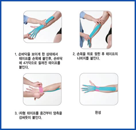 테이프 하나로 근육 통증을 완화시킨다 키네시오 테이핑3ns 네이버 블로그
