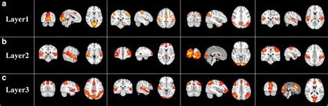 Figure 3 Hierarchical Individual Naturalistic Functional Brain