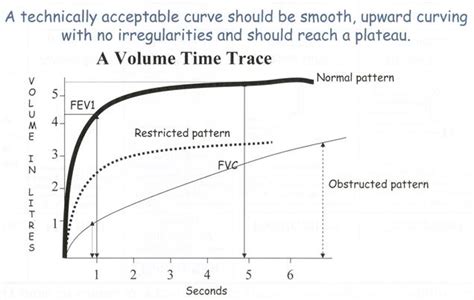 SPIROMETRY