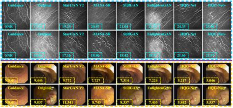 Visual Comparison Of Enhanced Results On Ccm And Colonoscopy Datasets