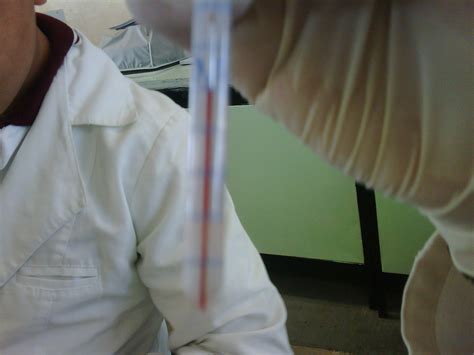 EdUrIrOm PRÁCTICA No CUENTA DE ERITROCITOS