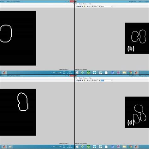 Average Tooth Root Surface Area For Each Tooth Type Download