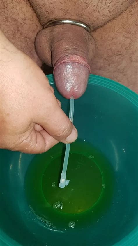 Catheter Sounding With My Urine 39 Nude Pics Xhamster