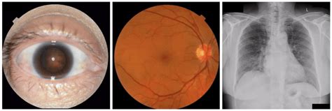 Using Generative Ai To Investigate Medical Imagery Models And Datasets