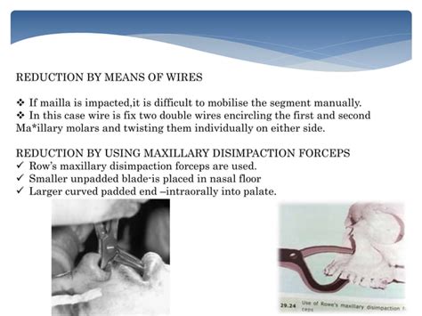 Maxillary Fracturepptx Death Injury Or Military Conflict