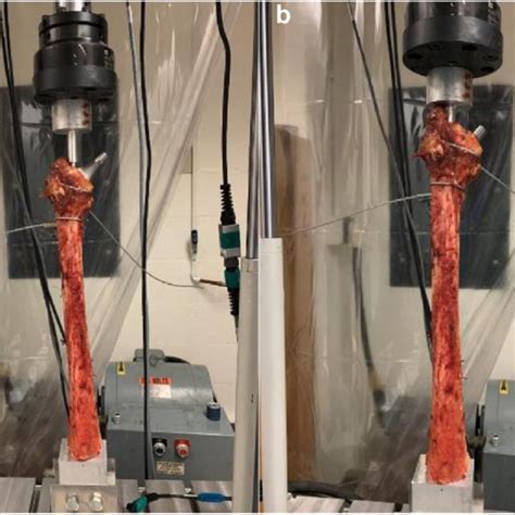 A Cadaveric Femur With Cables After Periprosthetic Fracture B