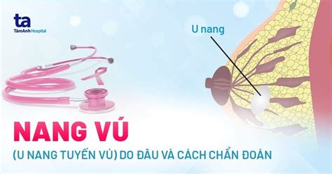 Nang V U Nang Tuy N V Nguy N Nh N Tri U Ch Ng V Ch N O N