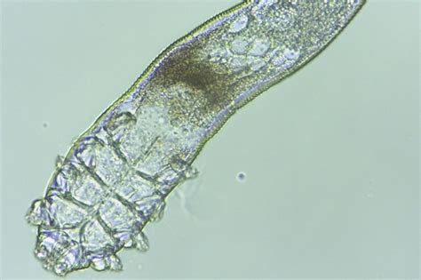 Don T Freak Out But There Are Thousands Of Mites Living All Over Your Face Vox