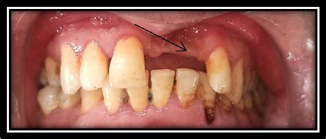 Online Open Access Dental Magazine Journal Publication Dentistry Journal