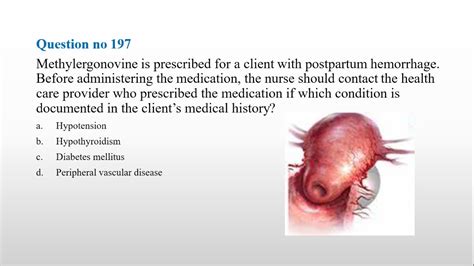 Review Of Prometric Test Questions L29 Youtube