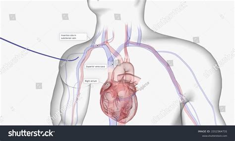 Left Subclavian Vein Anatomy