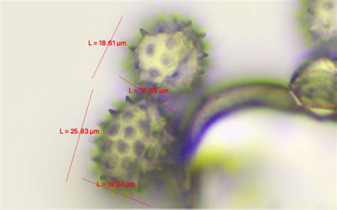 Flower Pollen Microscope