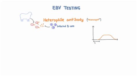 Ebv Lab Interpretation At Karen Watts Blog