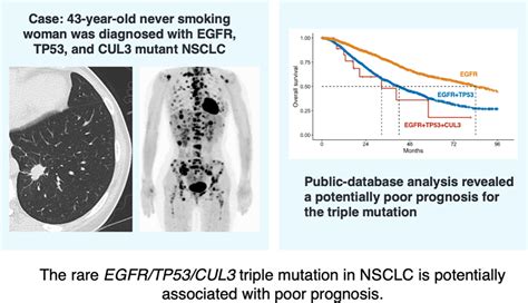 Thoracic Cancer Vol 16 No 3