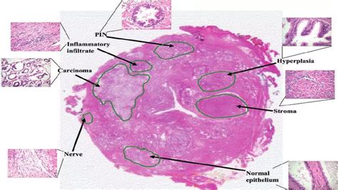 Эр бэлэг эрхтэн Гистологи Pptx