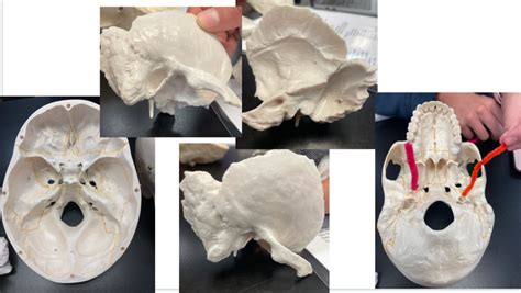 Temporal Bones Diagram Quizlet