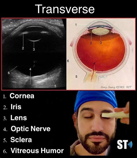 O Rads Us Risk Stratification And Management System A Consensus Guideline From The Acr Ovarian