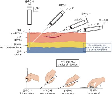 램시마sc의 가치에 대하여