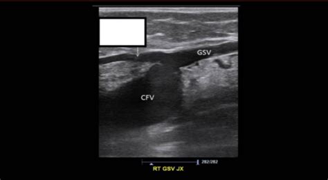 Lesson 2 Vein Mapping Practice Test Flashcards Quizlet