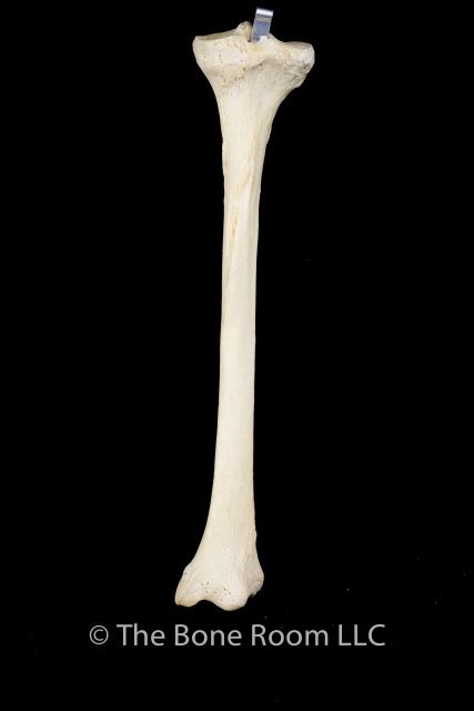 Human Tibia