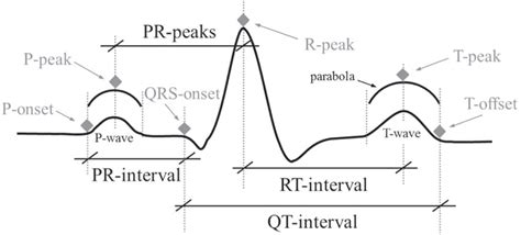 Identification Of The R Peak And Fiducial Points On Ecg Beat P Onset