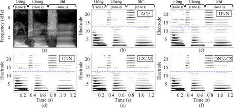 Figure 2 From Electrodenet—a Deep Learning Based Sound Coding Strategy