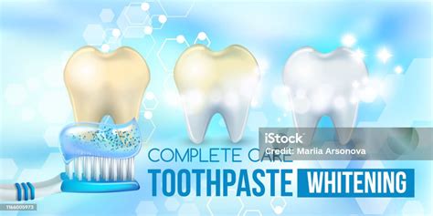 치과 개념 건강 치아구강 건강 광고 치아 미백 과정 치약이있는 파란색 플라스틱 칫솔3d 현실적인 치과 디자인 요소 광고 브로셔 및 교육 이빨에 대한 스톡 벡터 아트 및 기타