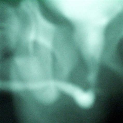 Classification Of Effman Download Scientific Diagram