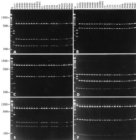Restriction Fragment Length Polymorphism Analysis Of Polymerase Chain Download Scientific