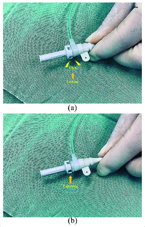 Sheath And Dilator A The Dilator Is Inserted Into The Sheath Until
