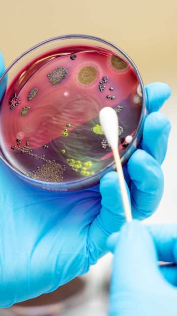 Stafilococul Auriu Ce Boli Poate Provoca și Cum Ne Ferim De El