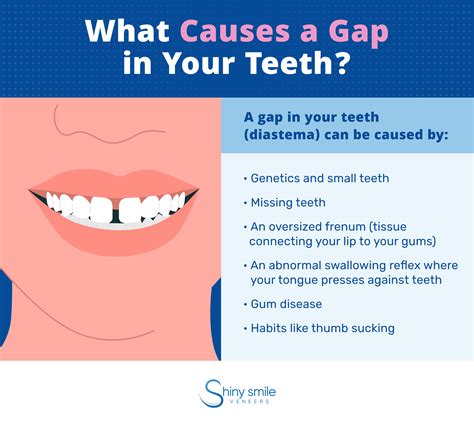 What Does Gap In The Teeth Mean