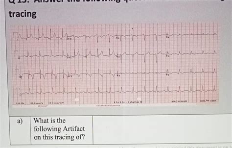 Solved Tracing Inthrotuthim 150 1kz A What Is The Following