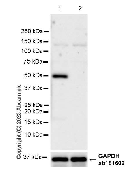 Anti Lipoprotein Lipase Antibody Epr28301 66 Ab316008 Abcam