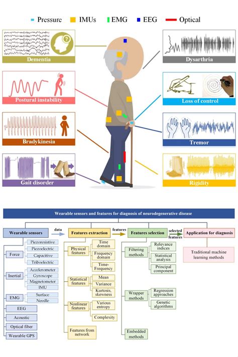 Wearable Sensors And Features For Diagnosis Of Neurodegenerative Diseases A Systematic Review