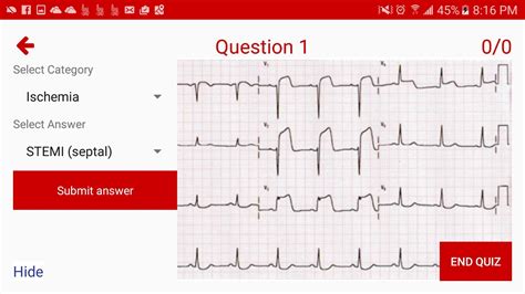 Updated Ecg Learning App Calculate Qtc Using A Picture And More Medicalschool
