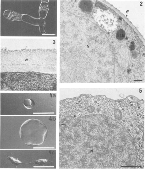 Transmission Electron Micrograph Showing The Fibrillar Structure Ofthe