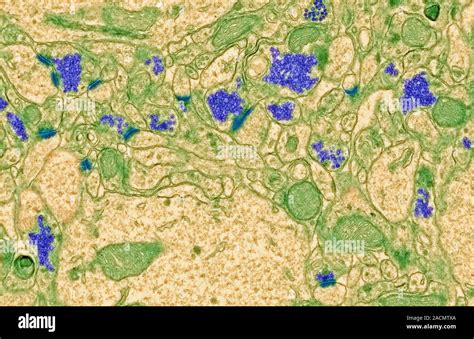Brain Synapses Coloured Transmission Electron Micrograph Tem Of A