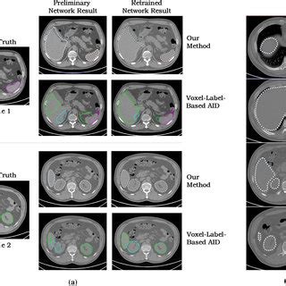 Visual Observation Of Organ Segmentation Results A Representative Download Scientific Diagram