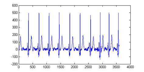 A The Original Ecg Record No106 From Mit Bih Arrhythmia Database