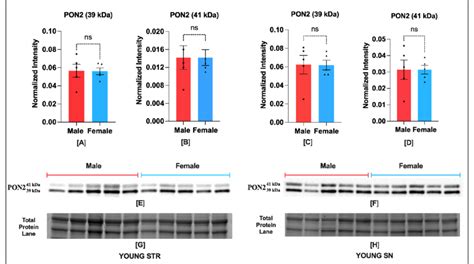 Young Nhp Brain Has No Sex Bias In Pon2 Isoforms Expression In Str And Young Nhp Brain Has No Sex Bias In Pon2 Isoforms Expression In Str And