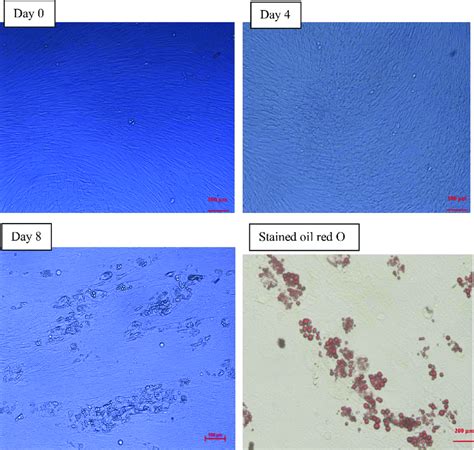 In Vitro Intramuscular Preadipocyte Differentiation Intramuscular