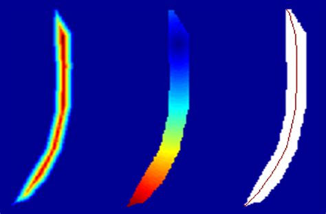 Depicts Various Steps During The Automated Centerline Extraction Download Scientific Diagram