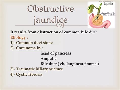 Jaundice Pptx