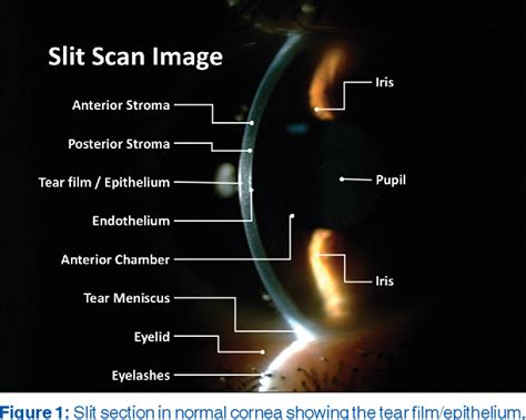 Cornea And Anterior Eye Assessment With Slit Lamp Biomicroscopy