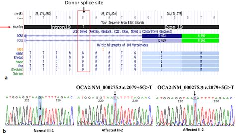 Mutation Analysis Of A Pakistani Oculocutaneous Albinism 53 Off